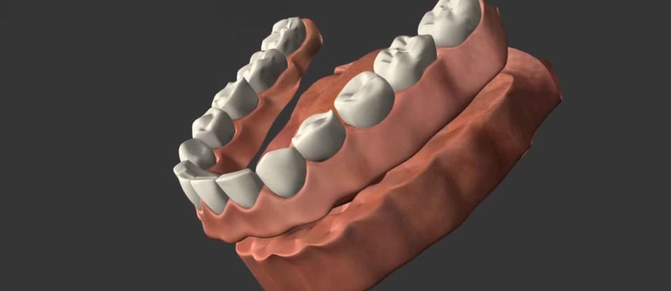Replace Missing Teeth | Glendale Dental Arts